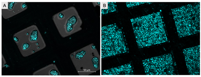 Chapter 2 – ET – Cryo EM 101