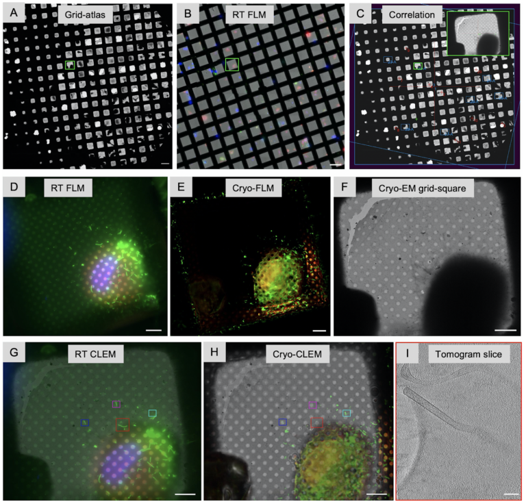 Chapter 2 – ET – Cryo EM 101