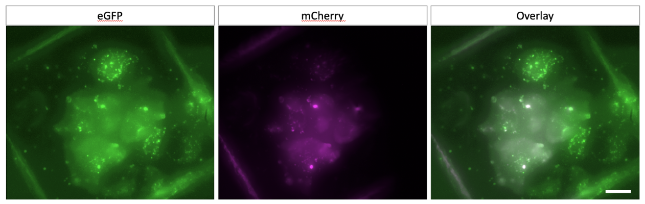 Chapter 3 – ET – Cryo EM 101