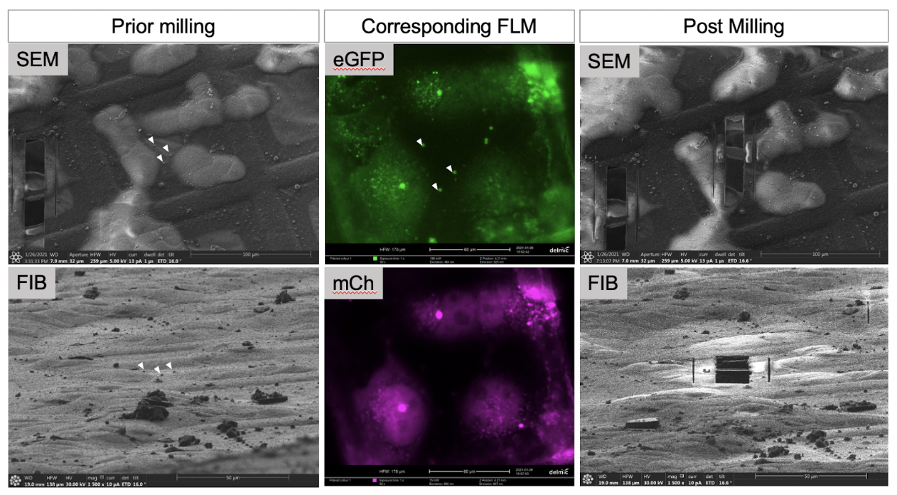 Chapter 3 – ET – Cryo EM 101