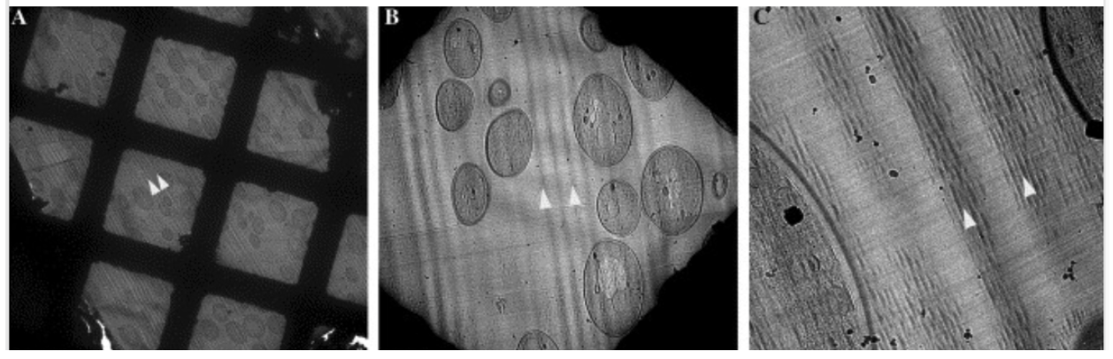 Chapter 3 – ET – Cryo EM 101