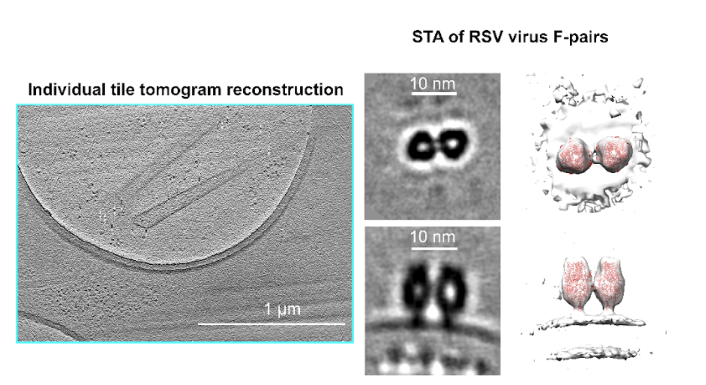Cryo-ET Chapter 4 – Cryo EM 101