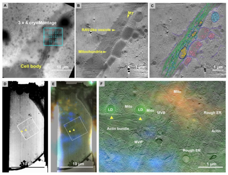 Cryo-ET Chapter 4 – Cryo EM 101